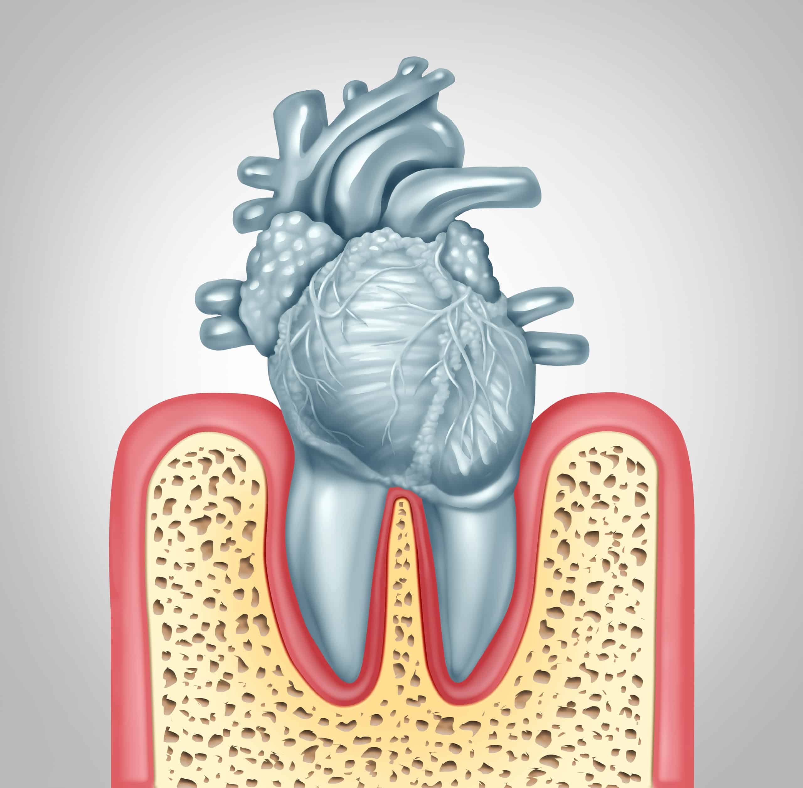 The Link Between Oral Health and Heart Disease - SLim Dental | Care for ...