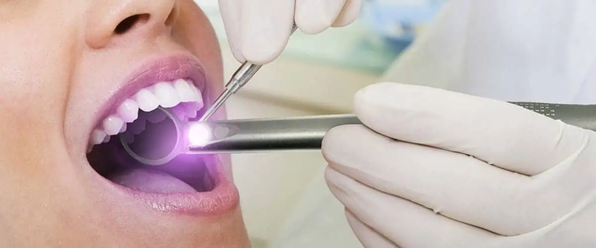 The Importance of Oral Cancer Screenings - SLim Dental | Care for your ...